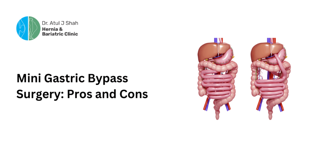 Mini Gastric Bypass Surgery: Pros and Cons | Dr. Atul Shah